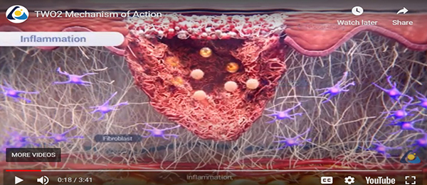 A Multi-Modality Therapy for Healing - Chronic Wounds