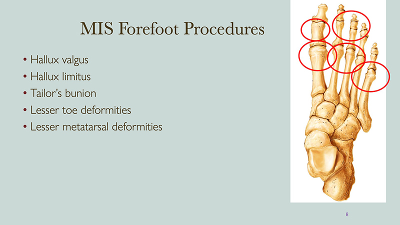 This Just In... - MIS Techniques that Work