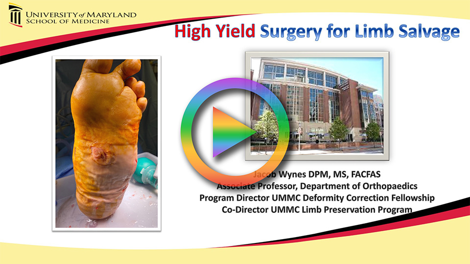 This Just In... - High Yield Surgery for Limb Salvage