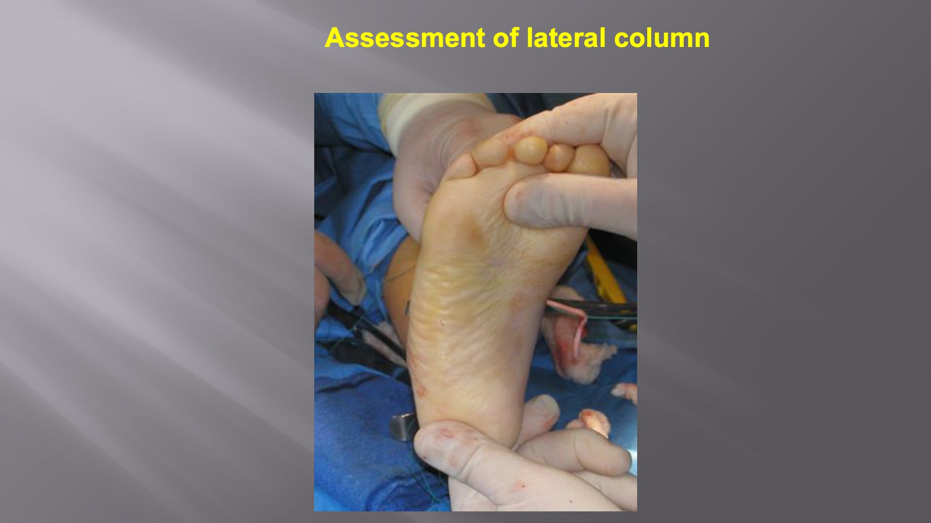 This Just In... - Pathomechanical Basis for Tendon Transfer Part 2
