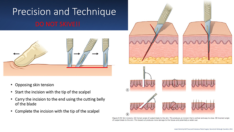 This Just In... - Principles of Skin Incisions and Primary Wound Healing