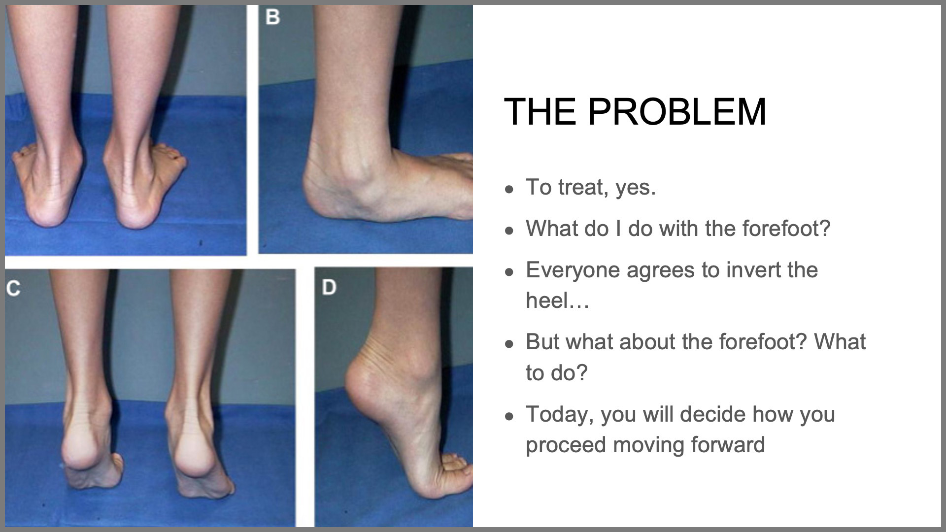 This Just In... - The Truth About the Twisted Plate Theory