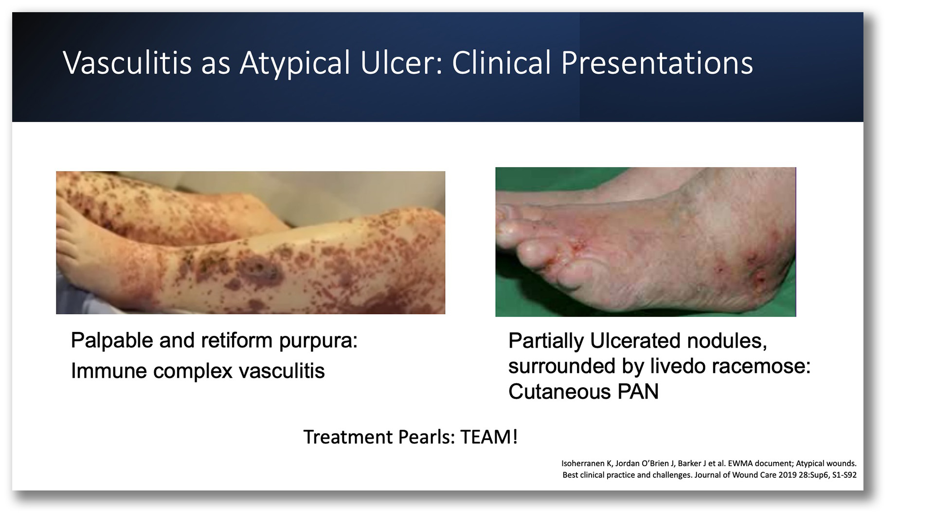 This Just In... - An Approach to Atypical Ulcers
