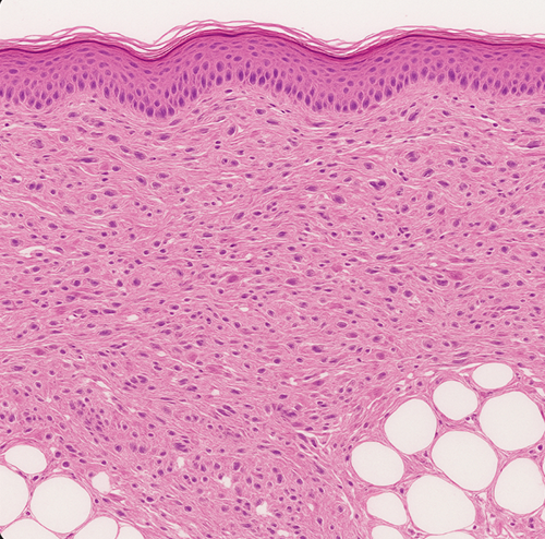 Practice Perfect 966 - Dermatopathology: A Glossary of Terms