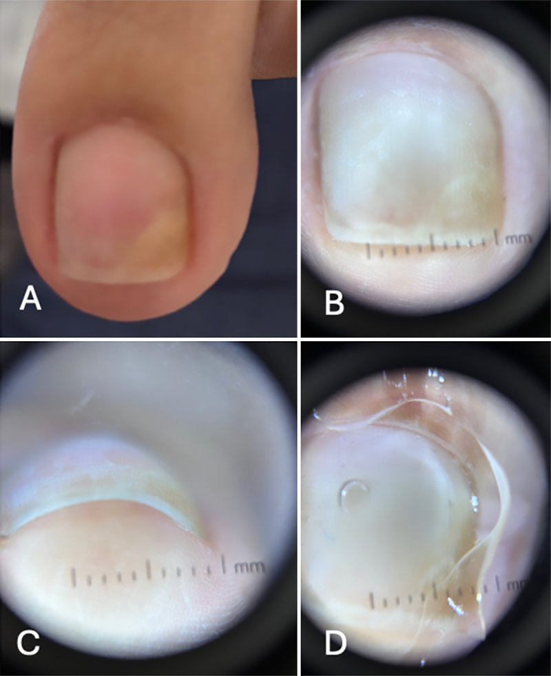 Practice Perfect 980 - Dermoscopy: A New Instrument for Podiatrists ...