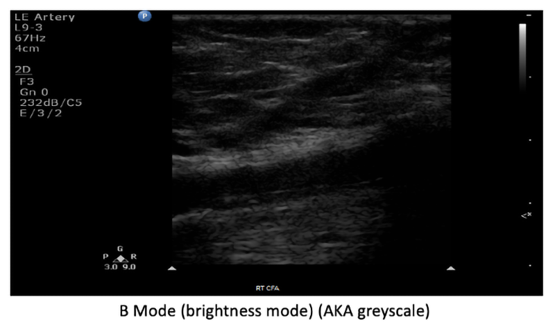 Practice Perfect 984 - Duplex Arterial Ultrasound for Podiatrists ...