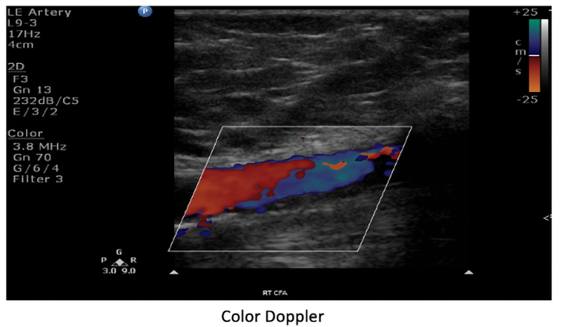 Practice Perfect 984 - Duplex Arterial Ultrasound for Podiatrists ...