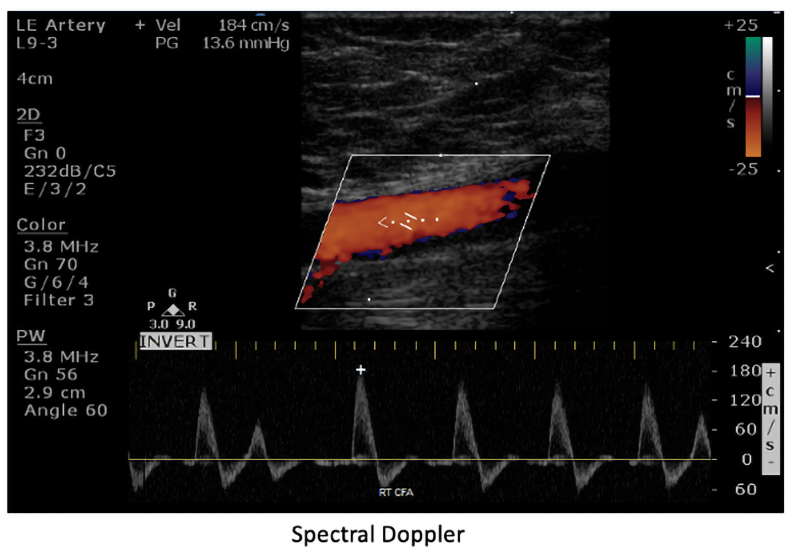 Practice Perfect 984 - Duplex Arterial Ultrasound for Podiatrists ...