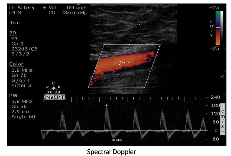 Practice Perfect 985 - Duplex Arterial Ultrasound for Podiatrists ...