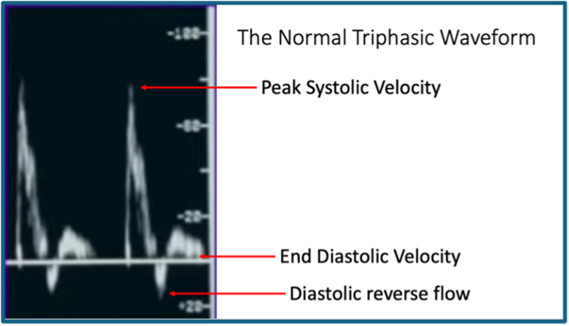 Practice Perfect 985 - Duplex Arterial Ultrasound for Podiatrists ...