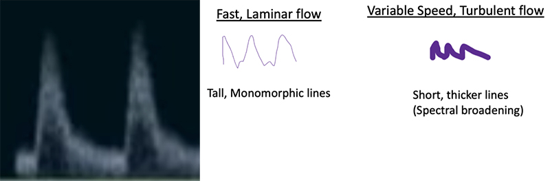 Practice Perfect 985 - Duplex Arterial Ultrasound for Podiatrists ...