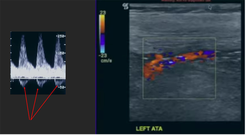 Practice Perfect 985 - Duplex Arterial Ultrasound for Podiatrists ...